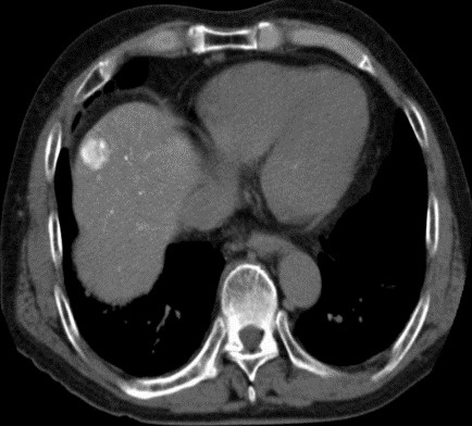 IVR-CT室 | 部門紹介 | 倉敷中央病院