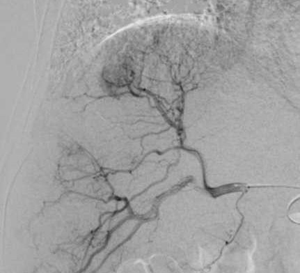IVR-CT室 | 部門紹介 | 倉敷中央病院